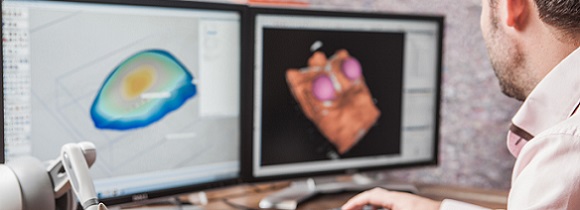 Сreating patient-specific chest implants with Artec 3D scanners and ...